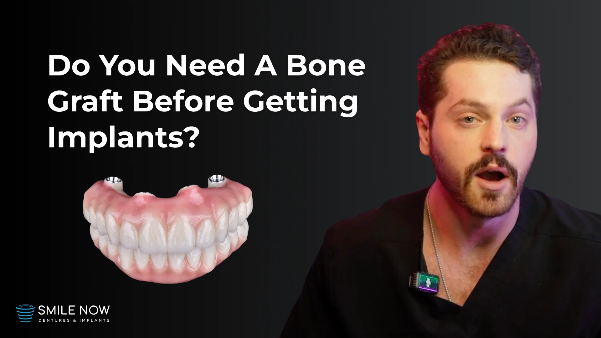 Do You Really Need A Dental Bone Graft Before Getting Implants? | Smile ...